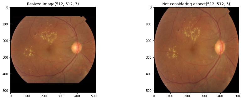 Blindness Classification Seung Hyun s Blog